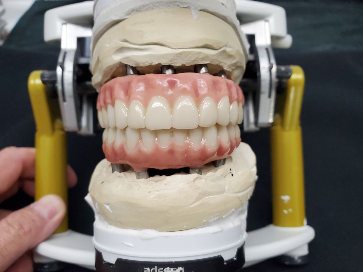 Precision Craftsmanship for Transforming Smiles | Solutions Dental ...